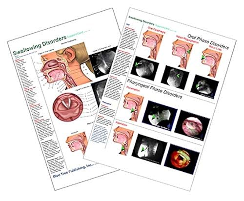 Swallowing Disorders Card, Speech Language Pathology Chart for ...
