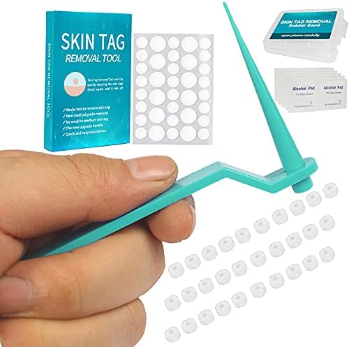 77PCS Skin Tag Remover for 2-5mm Skin Tag, Skin Tag Remover Patches ...