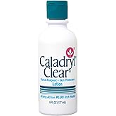 Amazon.com: Caladryl Clear Lotion, 6 Ounce : Health & Household