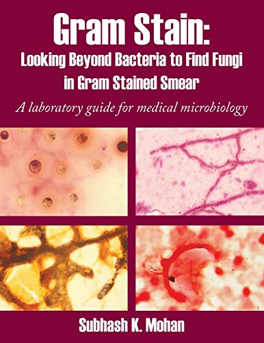 Gram Stain: Looking Beyond Bacteria to Find Fungi in Gram Stained Smear ...