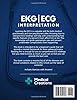 EKG/ECG Interpretation: Everything you Need to Know about the 12 - Lead ...