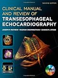 Practical Perioperative Transesophageal Echocardiography: Text with DVD-ROM, 2e: David ...