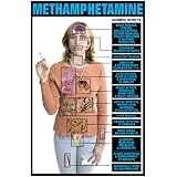 Harmful Effects of Heroin 24" X 36" Laminated Poster : Amazon.ca: Home