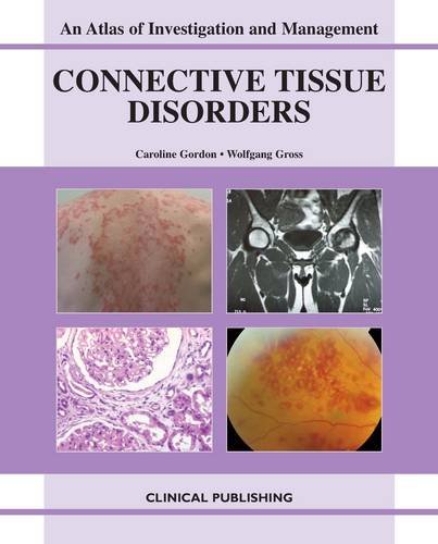 Connective Tissue Disorders: An Atlas of Investigation and Management ...