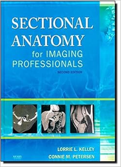 Sectional Anatomy for Imaging Professionals: 9780323020039: Medicine ...