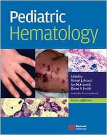 Pediatric Hematology: 9781405134002: Medicine & Health Science Books ...