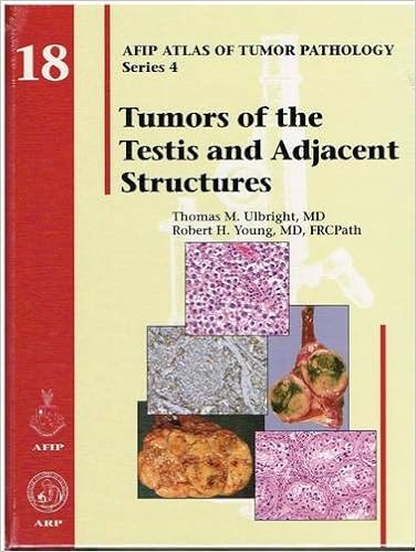 Pathology Outlines - Testis & paratestis
