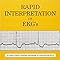 Rapid Interpretation of EKG's: Dr. Dubin's Classic, Simplified ...