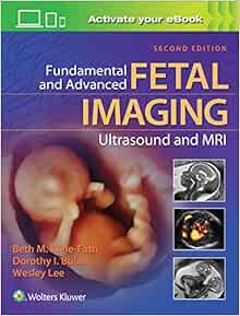 Fundamental and Advanced Fetal Imaging Ultrasound and MRI ...