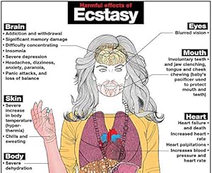 Amazon.com: Harmful Effects of Ecstasy 24" X 36" Laminated Poster ...