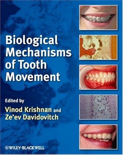 Biological Mechanisms of Tooth Movement in Oman | Whizz General