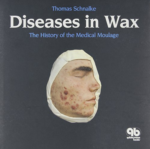 Diseases in Wax: the History of Medical Moulage: 9780867153064 ...