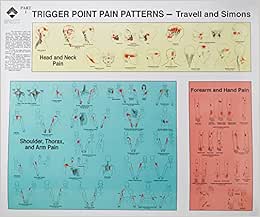 Trigger Point Pain Patterns Wall Charts: Upper and Lower Extremity ...