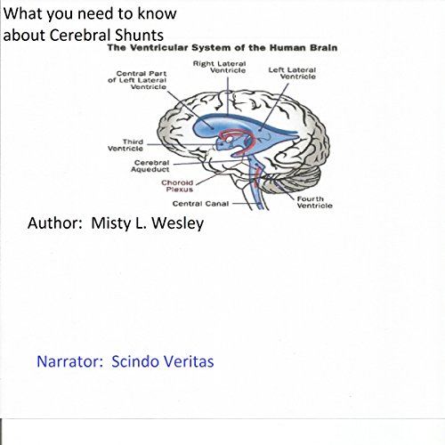 What You Should Know About Cerebral Shunts: Definition, Infection ...