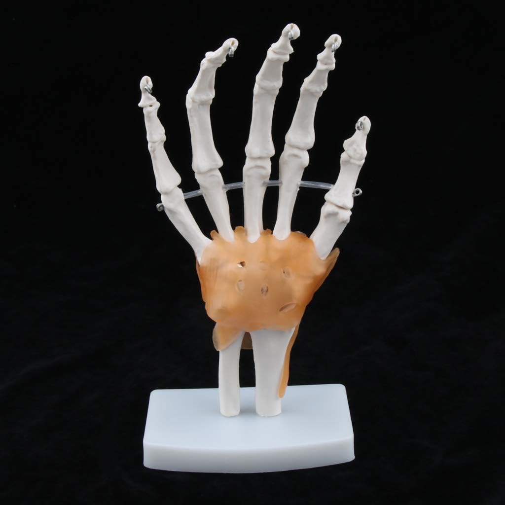 Represents Structure of Bones of Hand and Part of Radius and Ulna ...