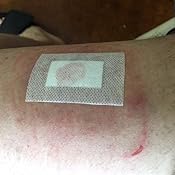 Amazon.com: 3M Tegaderm Transparent Dressing with Label 4" x 4 3/4" (10 ...