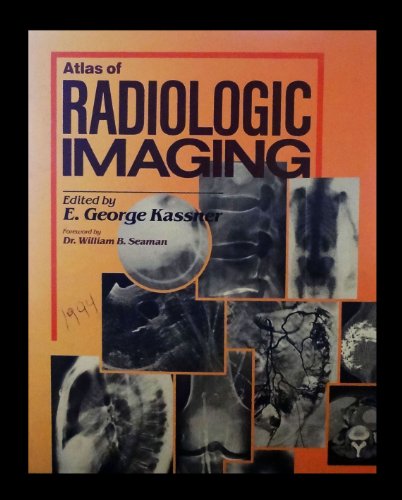 Atlas of Radiological Imaging: 9780397446612: Medicine & Health Science ...