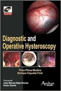 Diagnostic and Operative Hysteroscopy: 9781905740673: Medicine & Health ...