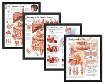 Set of 4 Framed Medical Posters The Digestive System, Diseases of The ...