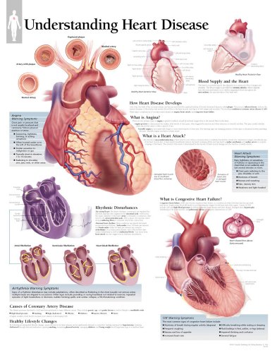 Understanding Heart Disease Paper Poster: Wall Chart | Amazon.com.br