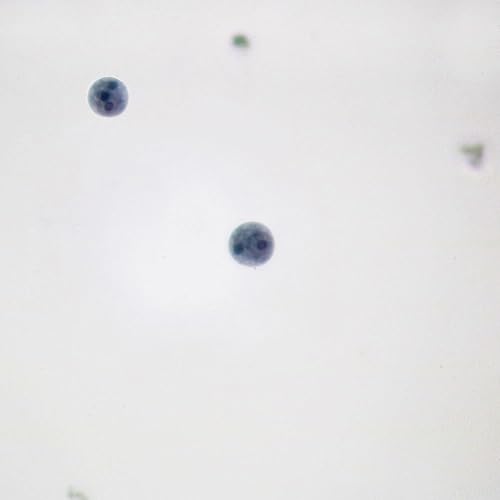 Entamoeba Histolytica Cysts, Smear Microscope Slide in Kenya | Whizz ...