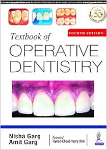 Textbook of Operative Dentistry: GARG, NISHA: 9789389587586: Amazon.com ...