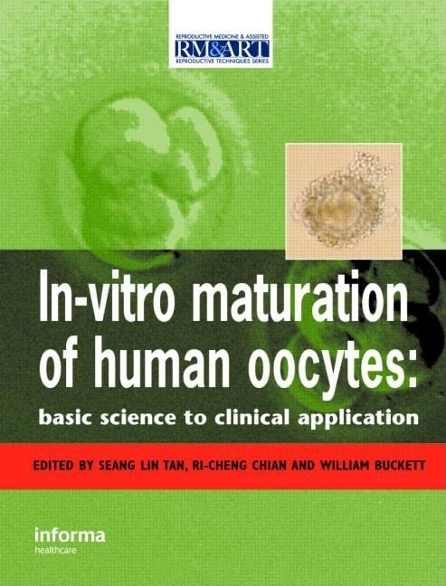 Buy In Vitro Maturation of Human Oocytes: Basic Science to Clinical ...