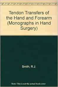 Tendon Transfers of the Hand and Forearm (Monographs in Hand Surgery ...