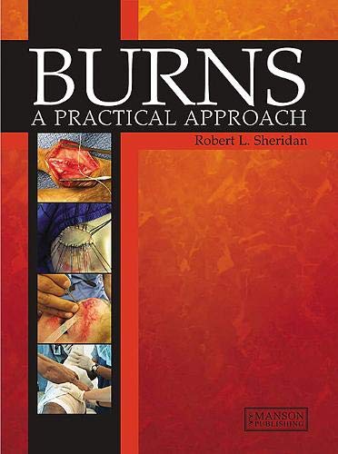 Burns: A Practical Approach to Immediate Treatment and Long Term Care ...