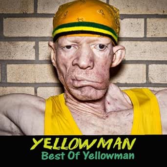 Best of Yellowman by Yellowman on Amazon Music - Amazon.com