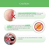 Best Scar Removal Creams in 2019 Reviews | Buyer's Guide