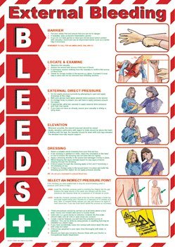 First Aid Poster - External Bleeding (Laminated Poster / 590x420mm ...
