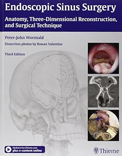 Endoscopic Sinus Surgery: Anatomy, Three-Dimensional Reconstruction ...