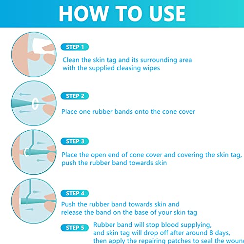 Micro Skin Tag Remover Kit - Painless Skin Tag Removal Tag Away Skin ...