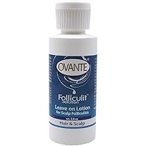 OVANTE Folliculitis Solution Shampoo, Treatment Of Scalp Folliculitis ...