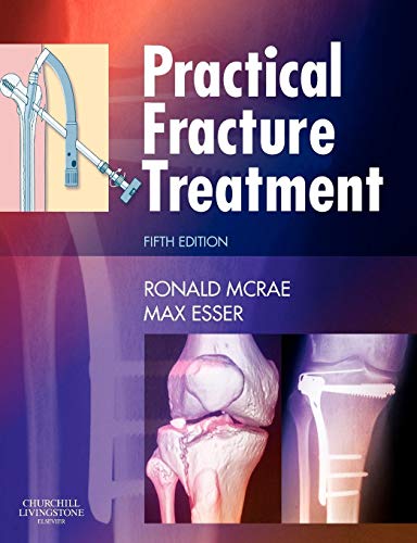 Practical Fracture Treatment: 9780443068768: Medicine & Health Science ...
