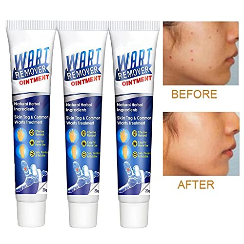 ITEM Wart Skin Bumps Remover WLIKKS Flat Wart Cream Instant item-wart-skin-bumps-remover-wlikks-flat-wart-cream-instant