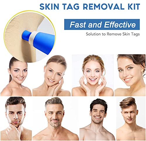 Skin Tag Remover, Skin Tag Removal Kit, Auto Tag Remover Tools, Remove ...