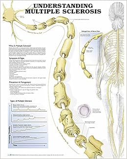Understanding Multiple Sclerosis Anatomical Chart: 9781587799723 ...