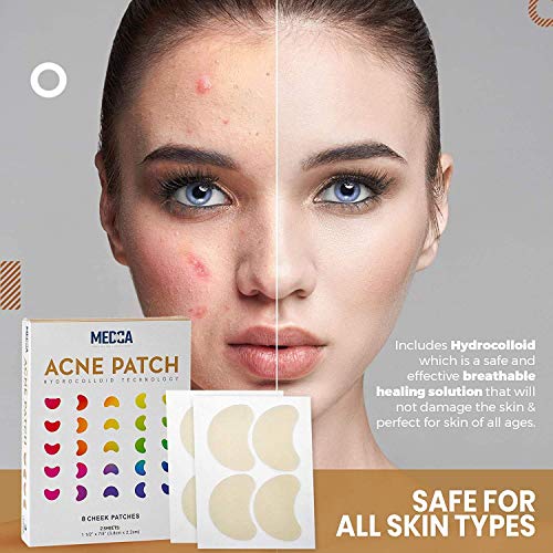 Acne Care Pimple Patch Absorbing Cover - Cheek Size Acne Spot Treatment ...