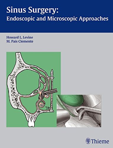 Sinus Surgery: Endoscopic and Microscopic Approaches: 9780865779723 ...