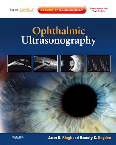 Ophthalmic Ultrasonography in Saudi Arabia | Whizz Ophthalmology