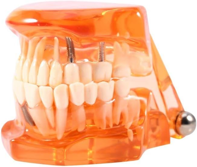 Dental Teeth Removable Tooth Model Tooth Prosthesis Demonstration Teeth ...