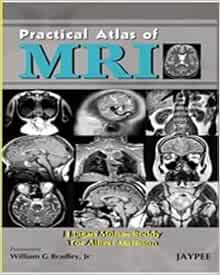 Practical Atlas of MRI: 9788184484892: Medicine & Health Science Books ...