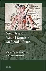 Amazon.com: Wounds and Wound Repair in Medieval Culture (Explorations ...