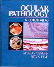 Ocular Pathology: A Color Atlas: 9780397446599: Medicine & Health ...