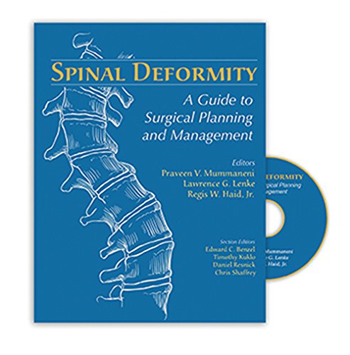 Spinal Deformity: A Guide To Surgical Planning And Management on ...