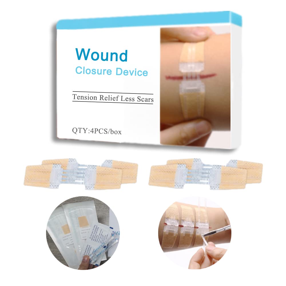 Mua 4Pcs Zip Stitch Sutures, Extra Large Steri Strips Wound Closure ...