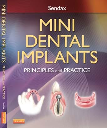 Mini Dental Implants - E-Book: Principles and Practice - Kindle edition ...