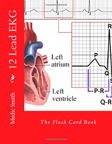 12 Lead EKG: The Flash Card Book: Smith, Medic: 9781499695519: Amazon ...